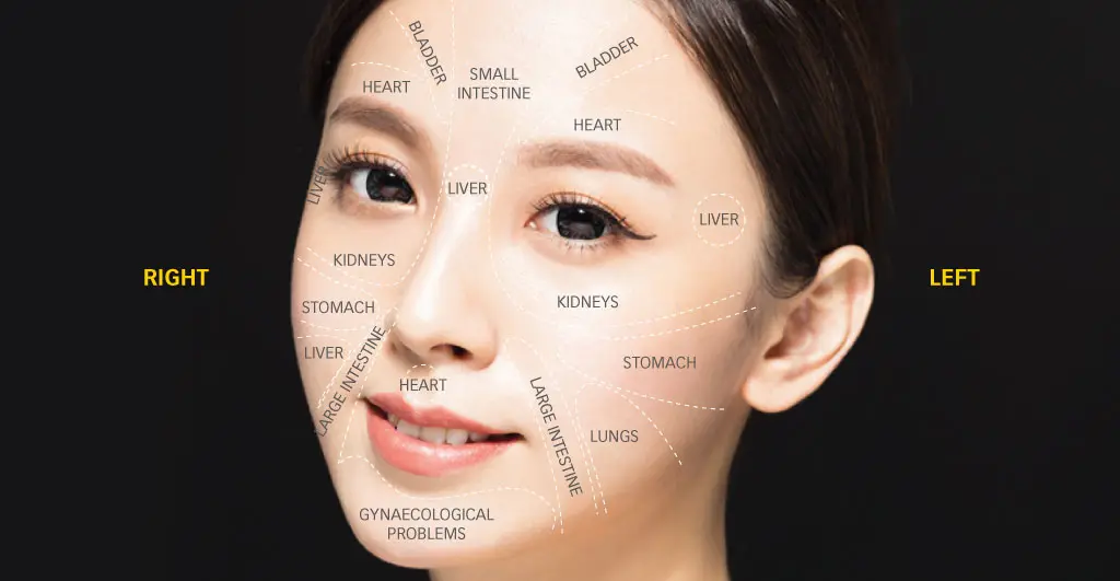 Learning about Acne – PULSE TCM Clinic