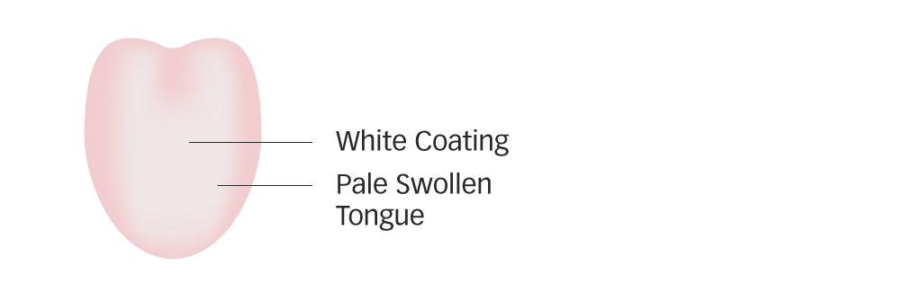 What Your Tongue Reflects About Your Health – PULSE TCM