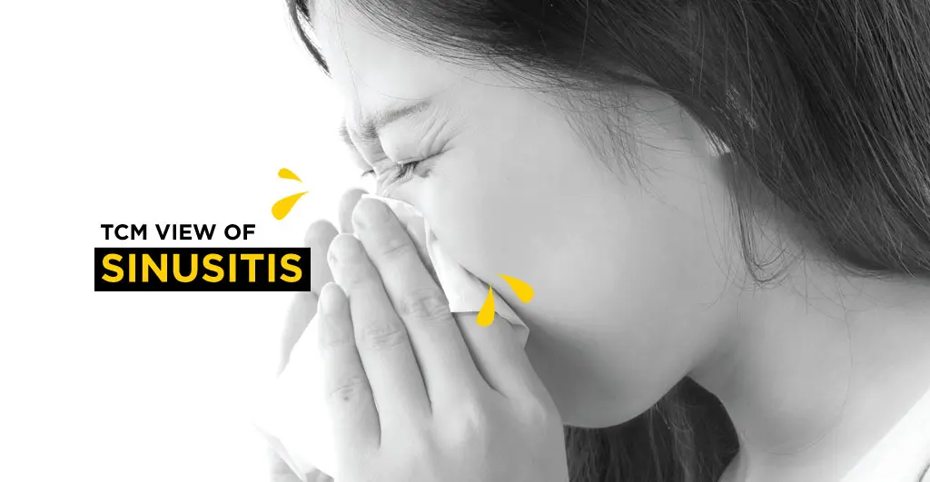 TCM View of Sinusitis – PULSE TCM