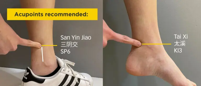 Acne Face Map: What Your Pimples Are Telling You – PULSE TCM Clinic