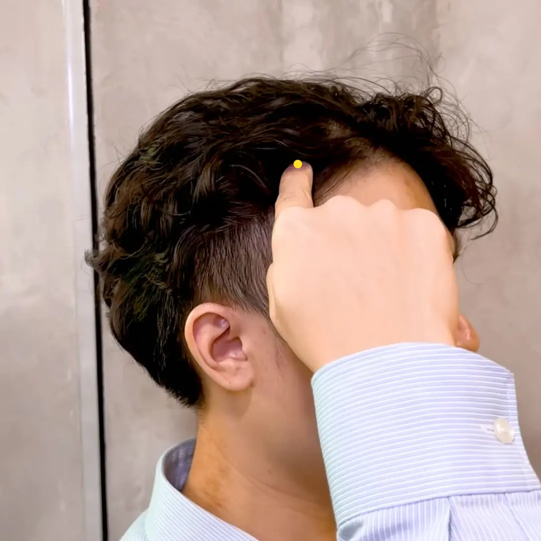 头维 (Tou Wei, ST8) – PULSE TCM