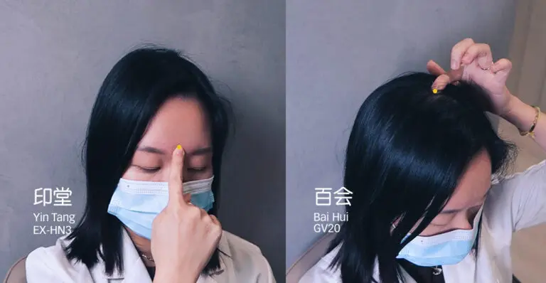 How is insomnia and stress related according to TCM theory? – PULSE TCM