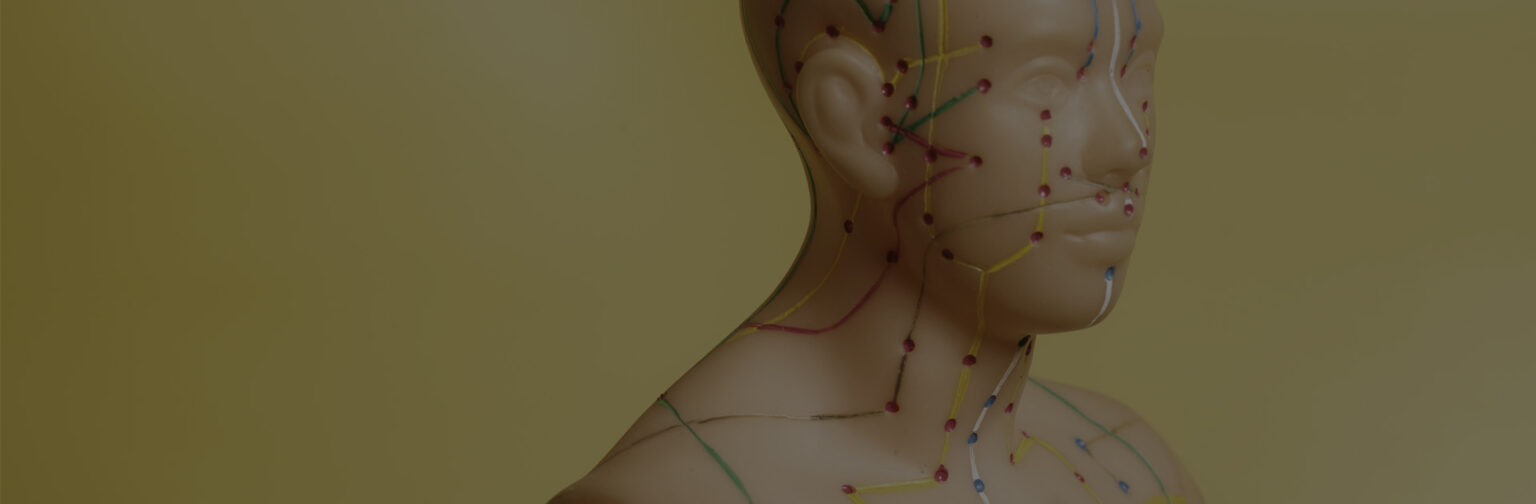 Acupuncture | PULSE TCM Clinic Singapore – PULSE TCM